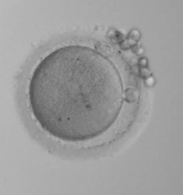 Responsible IVF: The missed opportunity of abnormally fertilised embryos